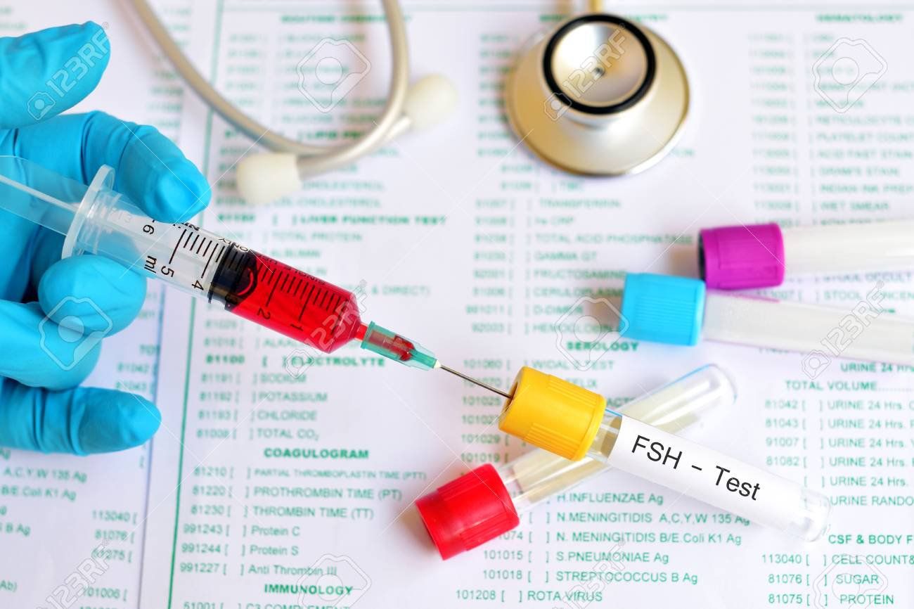 Hormone FSH là gì? | Vinmec