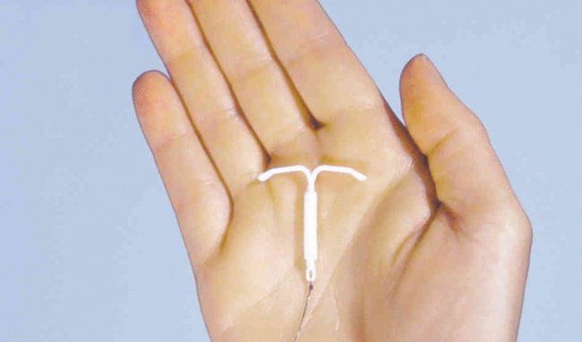 Having Sex After Iud Insertion Vinmec
