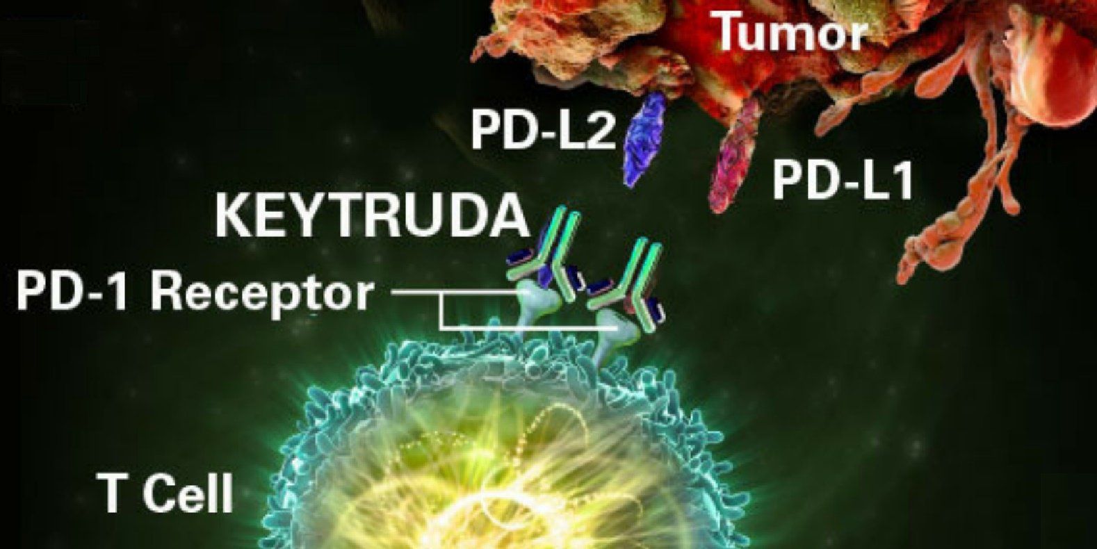 Liệu pháp miễn dịch với Keytruda trên bệnh nhân ung thư vùng đầu cổ ...
