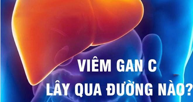 Những con đường lây truyền virus viêm gan C | Vinmec