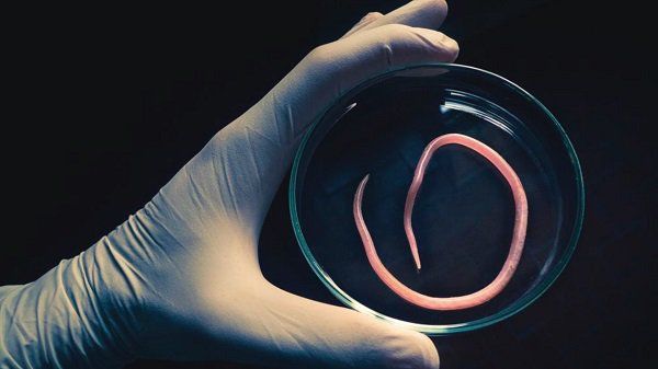 How often should children be dewormed periodically? | Vinmec