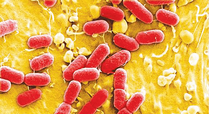 What is considered a high blood urea nitrogen (BUN) level? | Vinmec