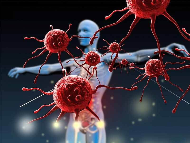 Thế nào là bệnh tự miễn? | Vinmec