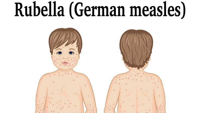 3 giai đoạn phát triển của rubella | Vinmec