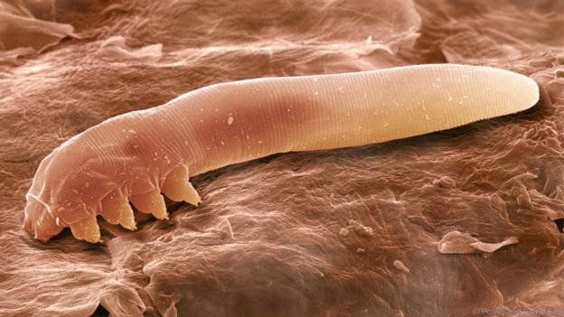 Phác đồ điều trị Demodex | Vinmec