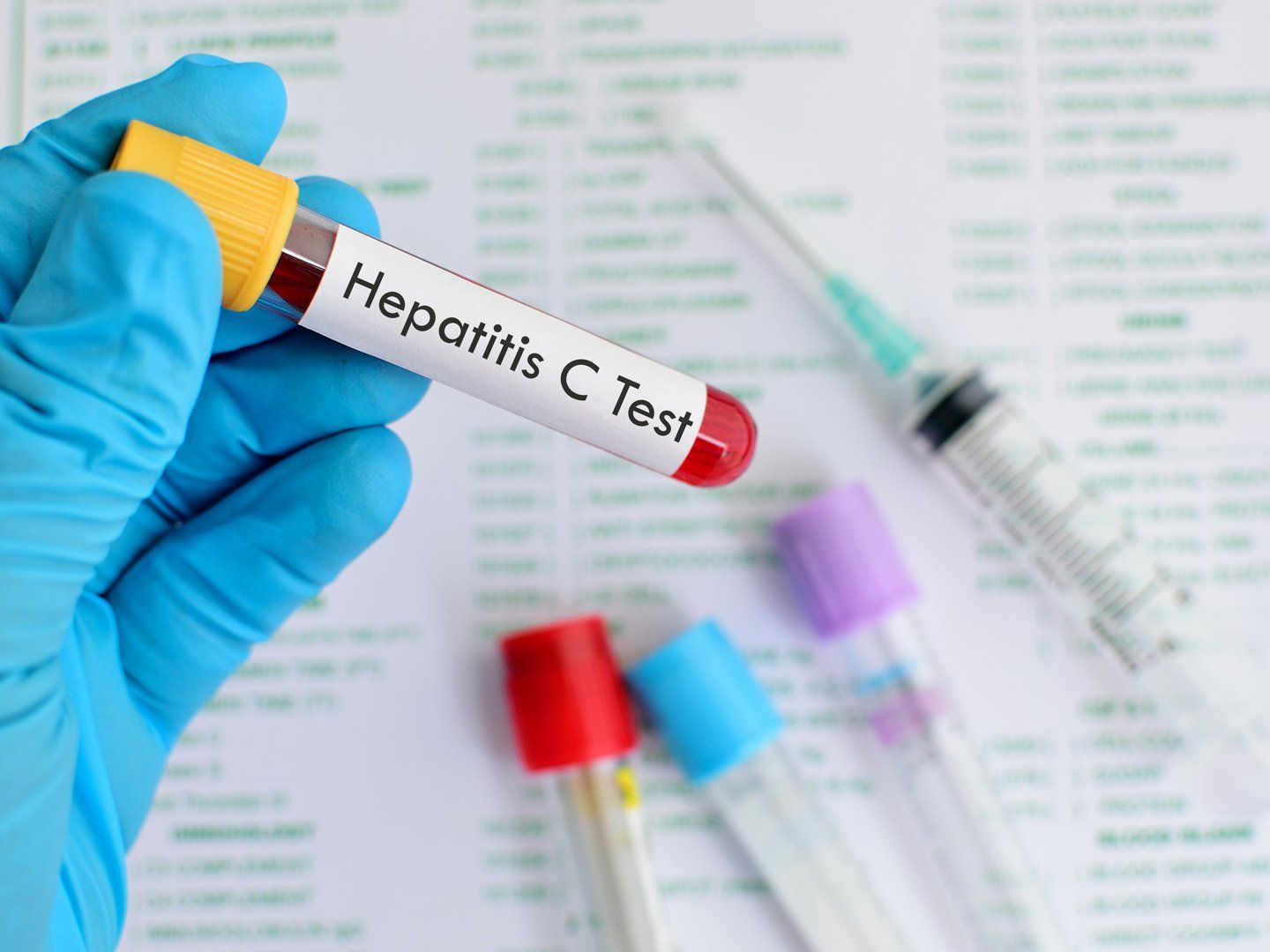 Vai trò của xét nghiệm HCV Ab miễn dịch tự động | Vinmec