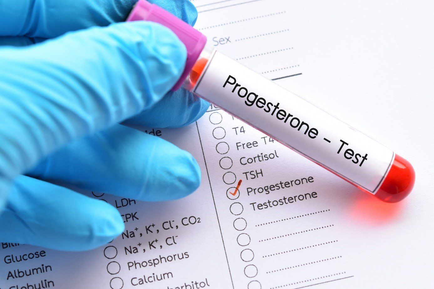 Understanding high progesterone levels | Vinmec