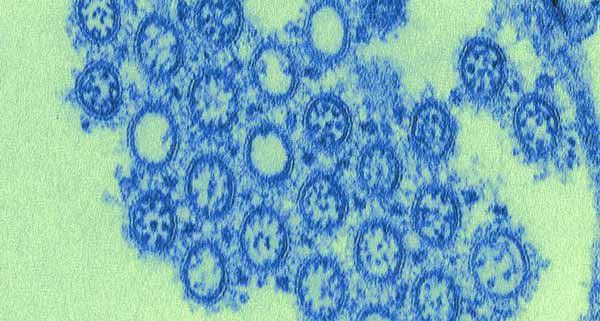 Virus cúm A: Những điều cần biết | Vinmec
