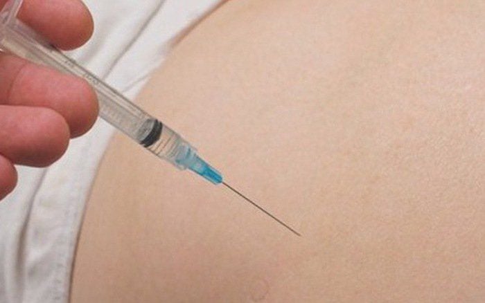 Why buttock injections? | Vinmec