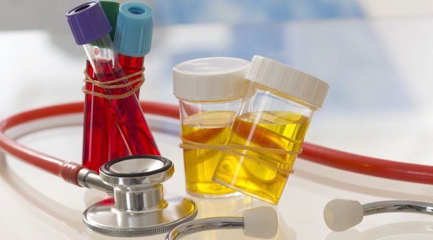 Understanding Normal Urine Test Results: A Comprehensive Guidance ...