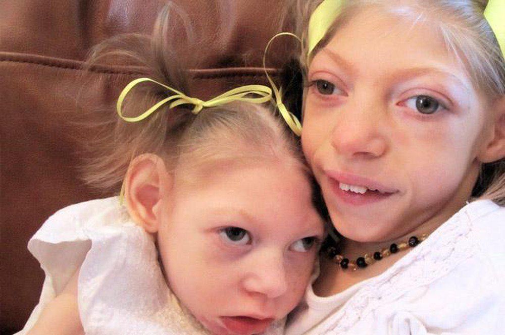 Bệnh Batten là bệnh gì? | Vinmec