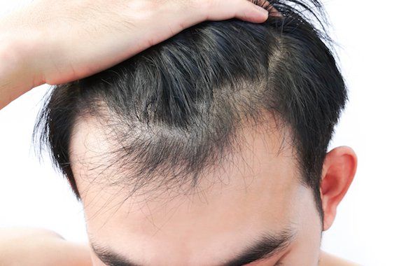 Nang tóc: Chức năng và giải phẫu | Vinmec