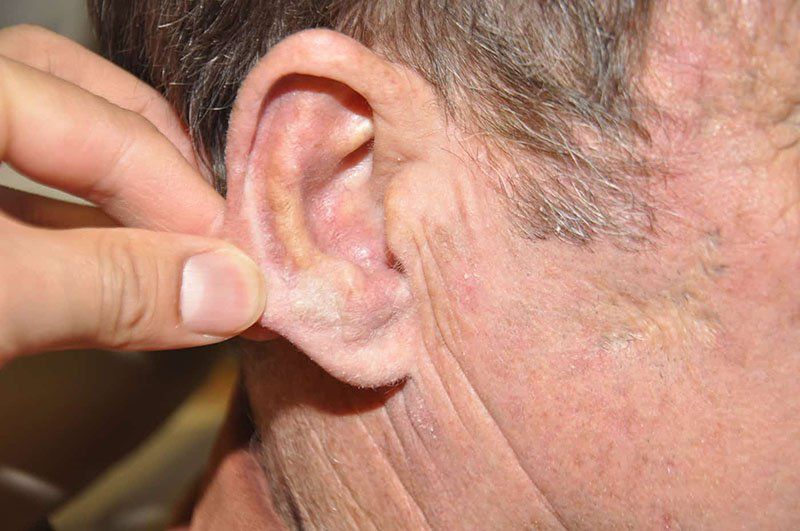 How dangerous is ear cancer? | Vinmec