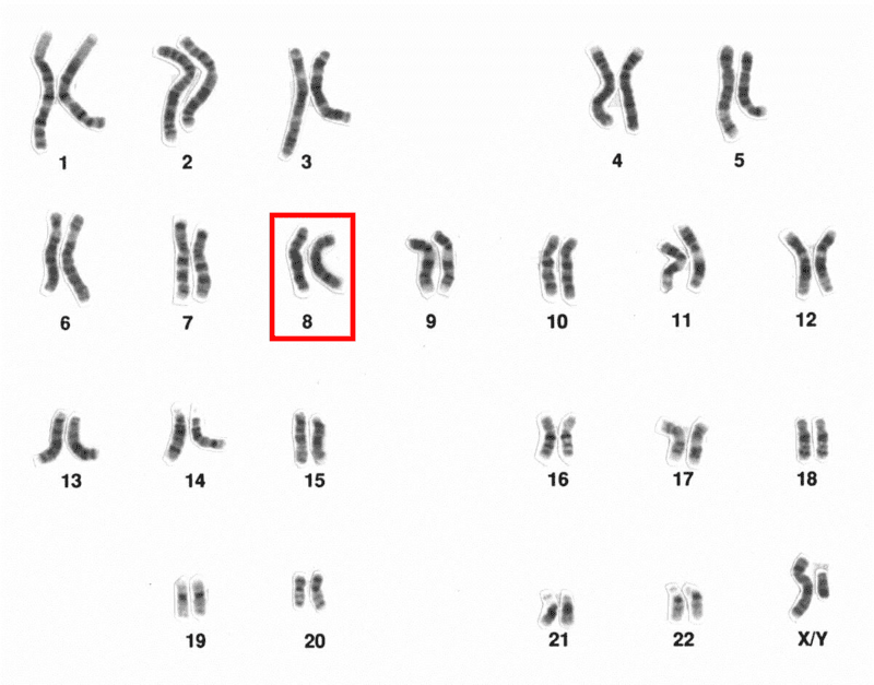 Nhiễm sắc thể 8, Monosomy 8p | Vinmec