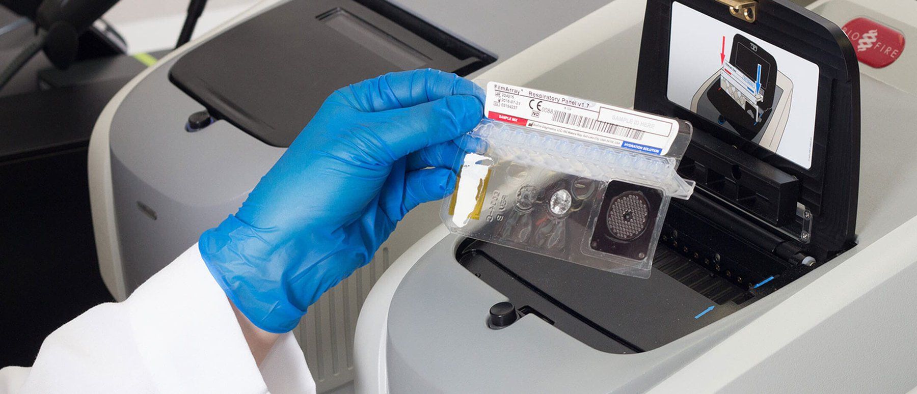 Hệ thống Filmarray - Công nghệ hiện đại | Vinmec