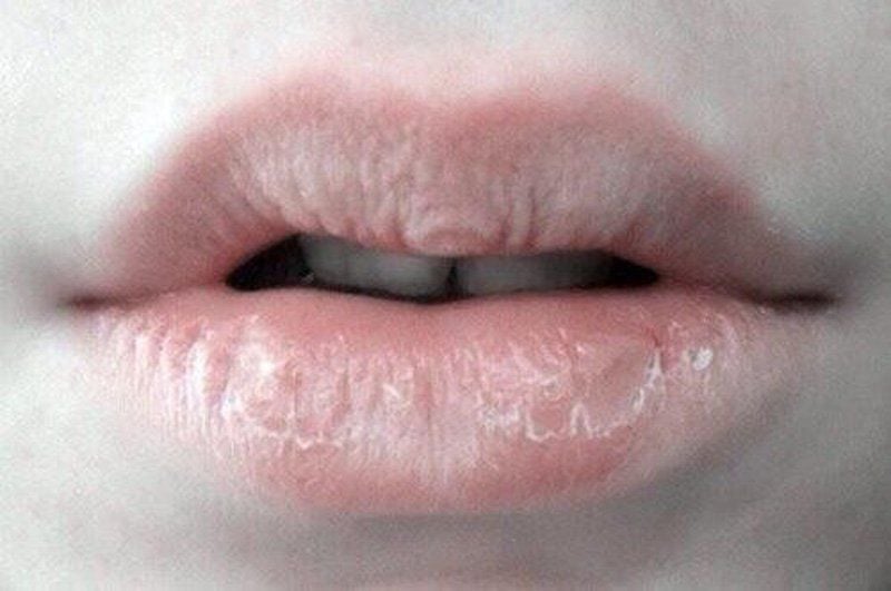 What nutrients are you lacking if you have dry lips all the time? | Vinmec