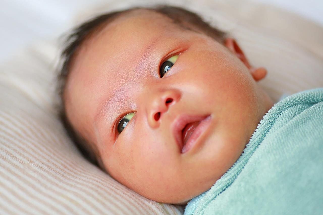 Why is a newborn's skin uneven in color? | Vinmec