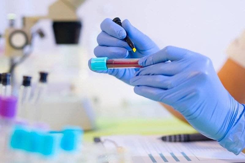 Meaning of HCV RNA Test Results: "Below the Detection Limit" and "Not ...