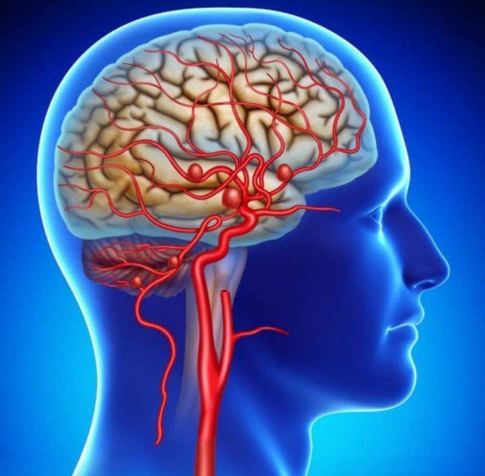 Người bệnh nhồi máu não người tím tái, chỉ số SpO2 78% có sao không ...