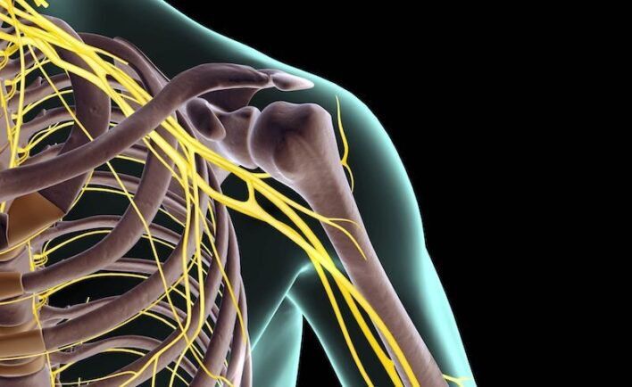 Treatment Of Brachial Plexus Vinmec