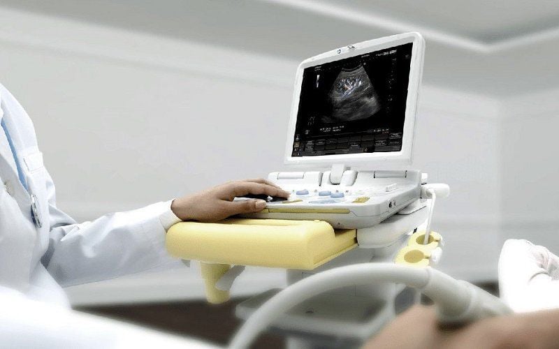 How long after an IVF embryo transfer can you hear a heartbeat? | Vinmec