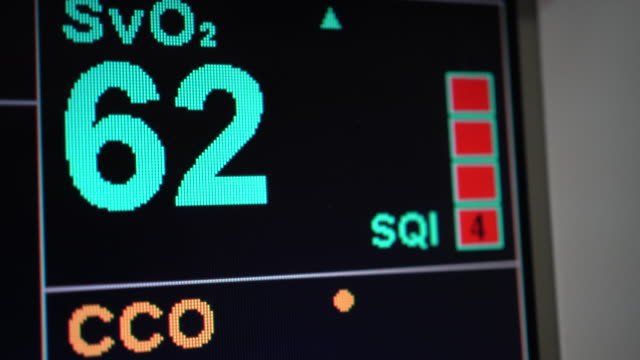 Chỉ số SCVO2 là gì? | Vinmec